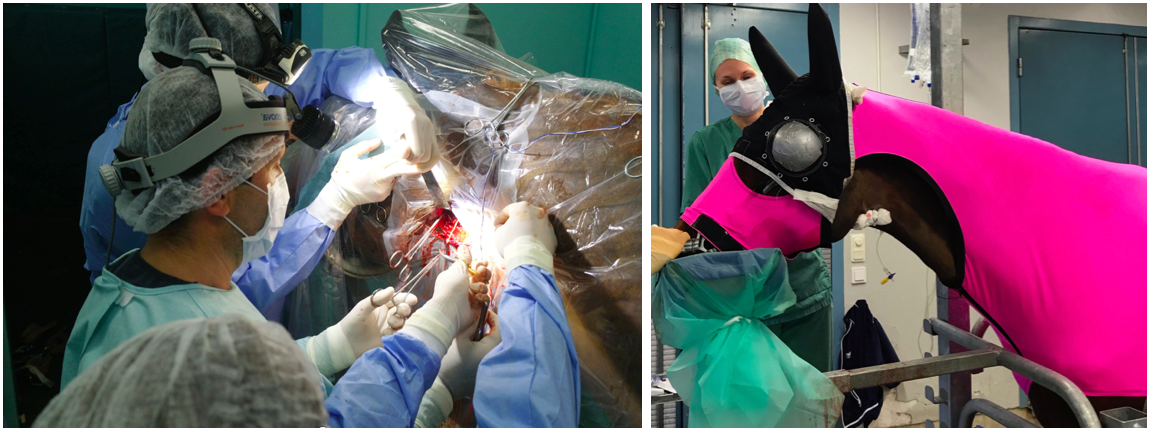 En quoi consiste une chirurgie de "Tie Back"